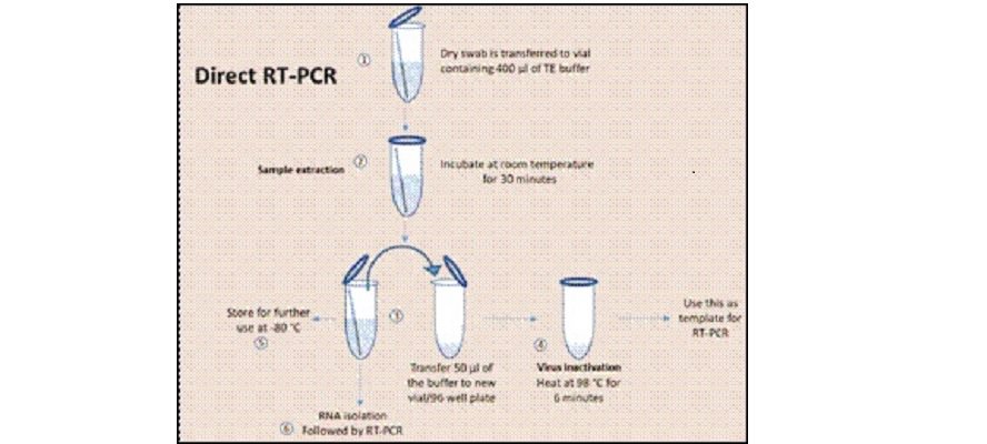SpiceHealth to be first to launch CSIR-CCMB’s dry swab direct RT-PCR ...