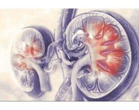 Johnson & Johnson launches new intraocular lens TECNIS PureSee in India ...